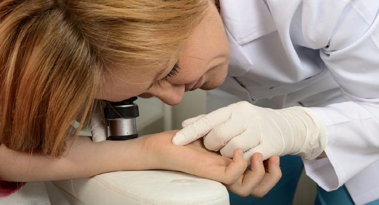 Is Actinic Keratosis Skin Cancer? What You Need to Know About this ...