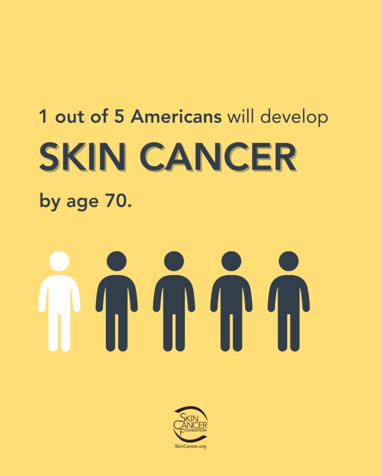 Skin Cancer Awareness Month Toolkit