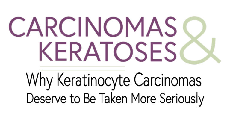 Carcinoma a cellule squamose