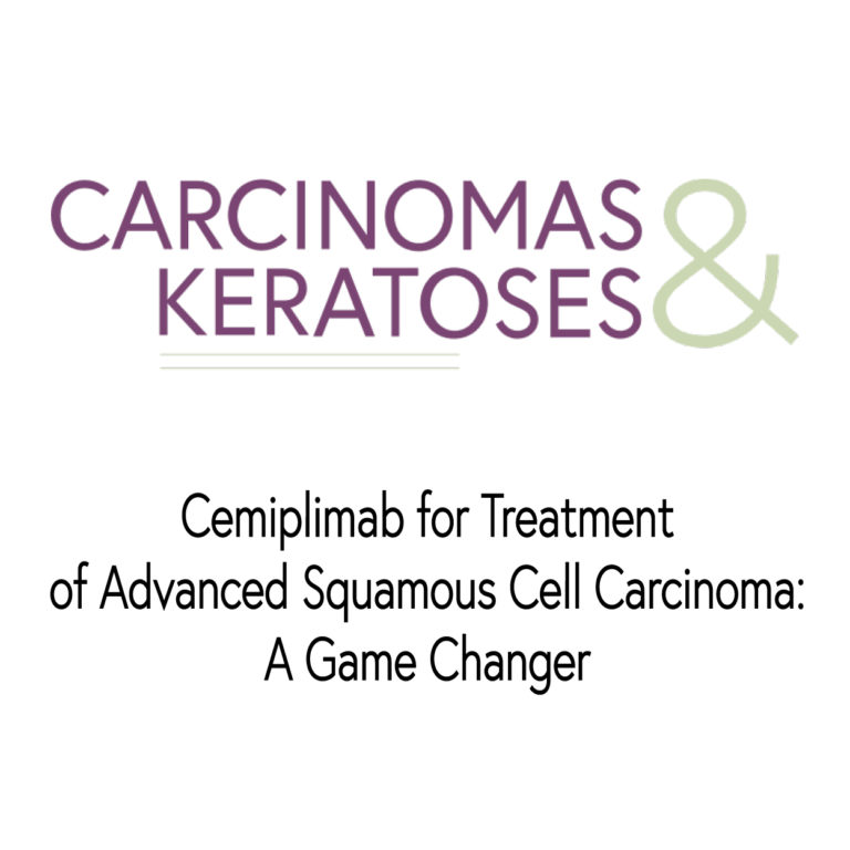 Advanced Squamous Cell Carcinoma Treatment